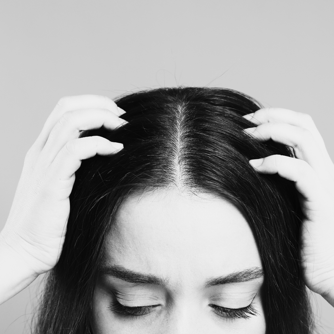 5 Signs of an Unhealthy Scalp and How to Fix It – Dust & Glow